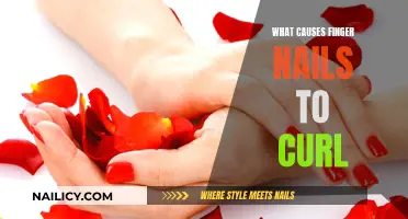 Understanding Dry Skin Around Finger Nails: Causes And Solutions | Nailicy