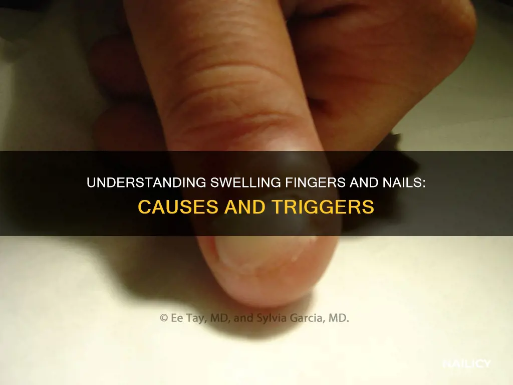 Understanding Swelling Fingers And Nails: Causes And Triggers | Nailicy