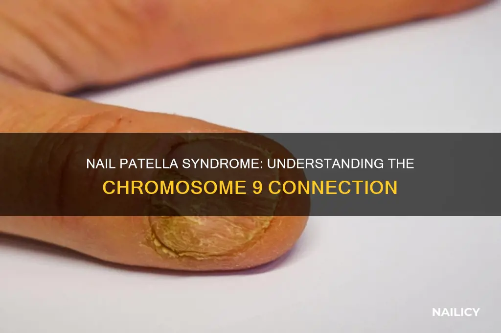 Nail Patella Syndrome: Understanding The Chromosome 9 Connection | Nailicy