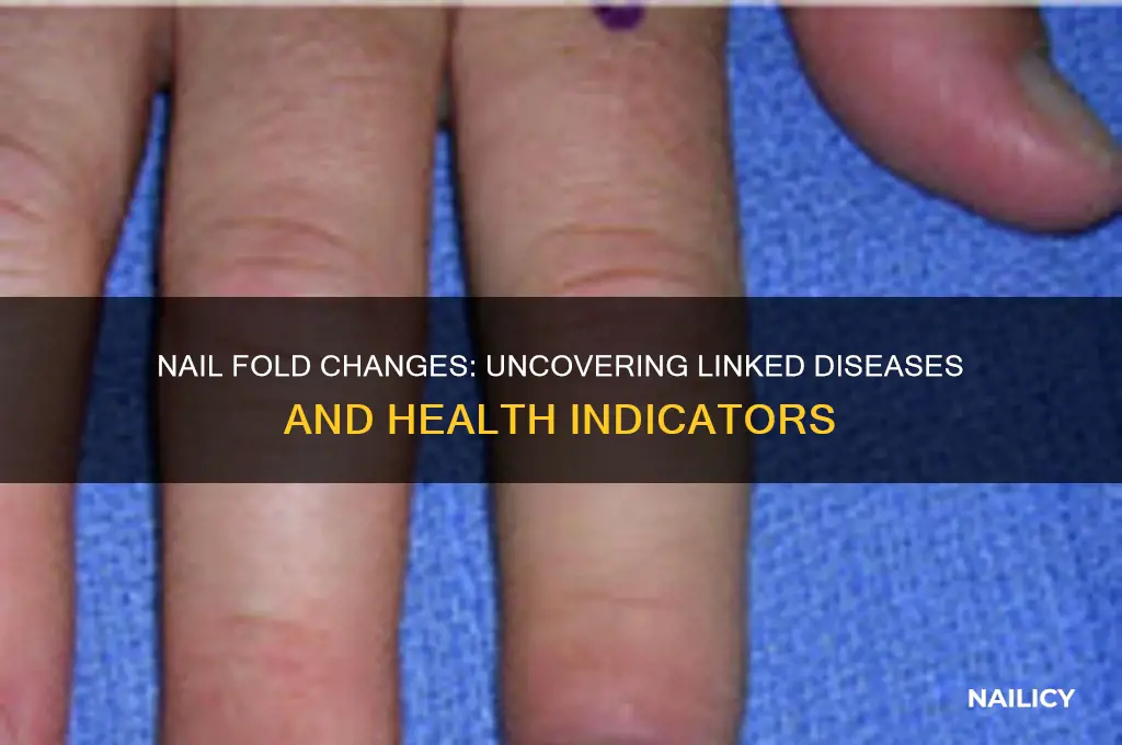 Nail Fold Changes: Uncovering Linked Diseases And Health Indicators ...