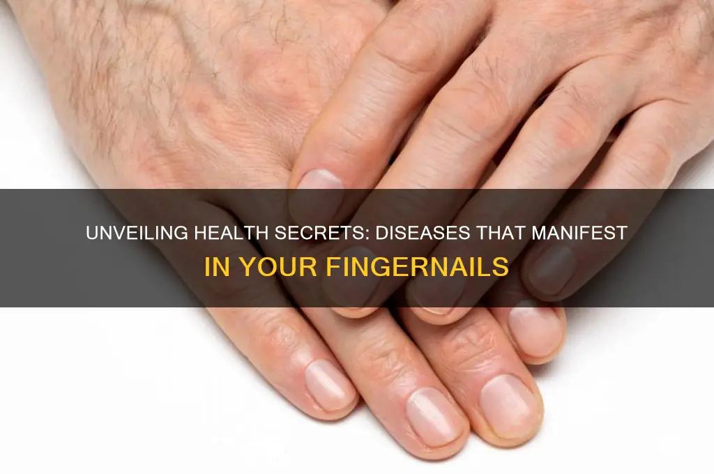 Unveiling Health Secrets: Diseases That Manifest In Your Fingernails ...