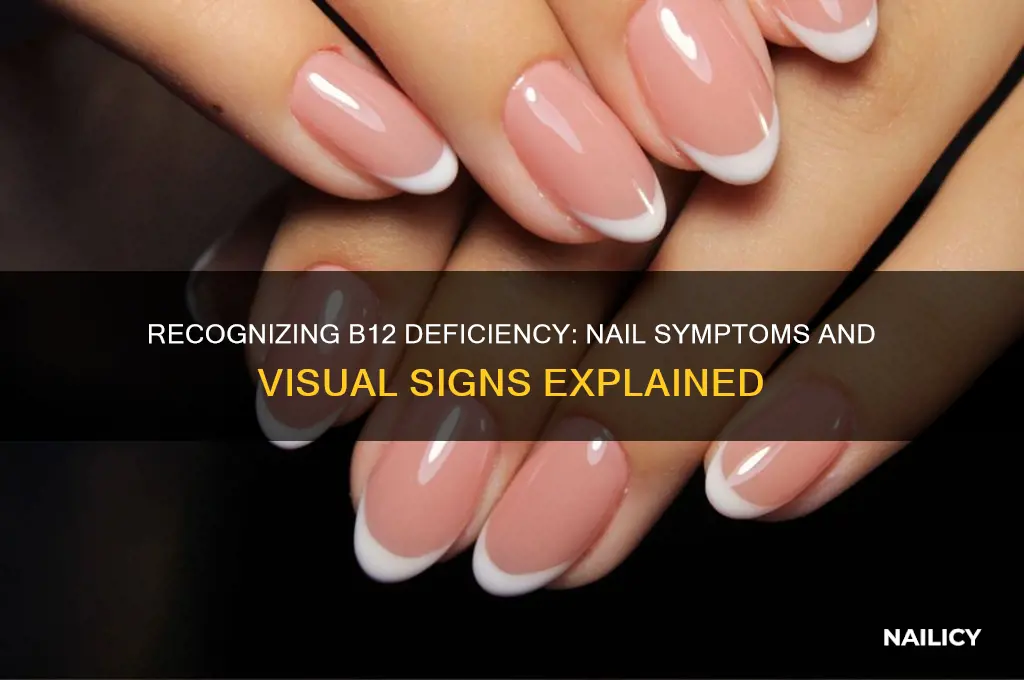 Recognizing B12 Deficiency: Nail Symptoms And Visual Signs Explained ...