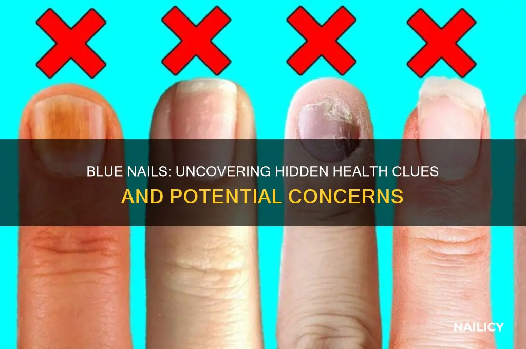 Blue Nails: Uncovering Hidden Health Clues And Potential Concerns | Nailicy