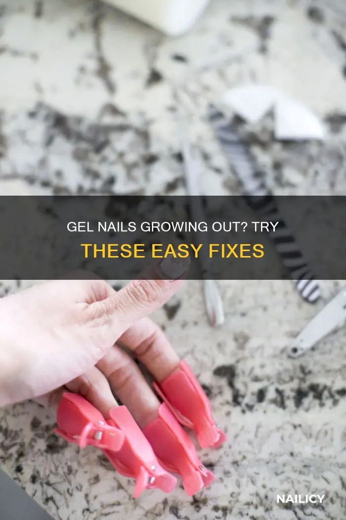 Gel Nails Growing Out? Try These Easy Fixes | Nailicy