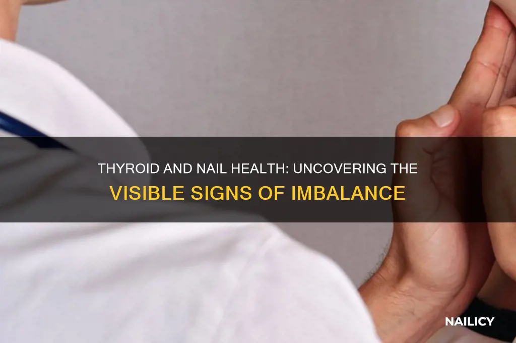 Thyroid And Nail Health: Uncovering The Visible Signs Of Imbalance ...