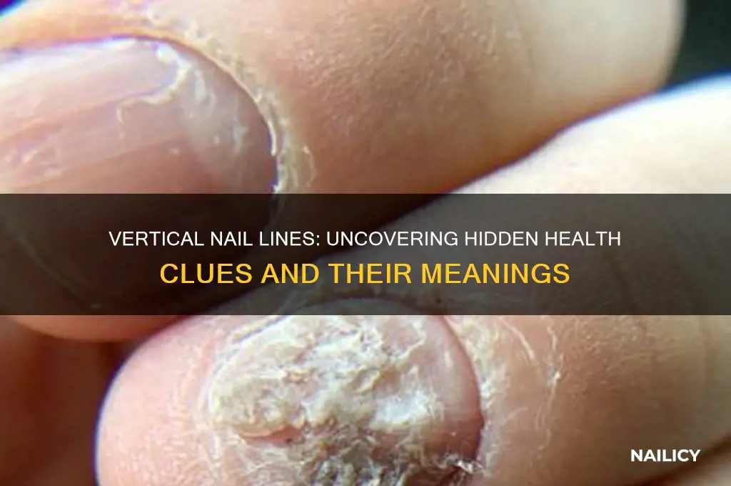 Vertical Nail Lines: Uncovering Hidden Health Clues And Their Meanings ...