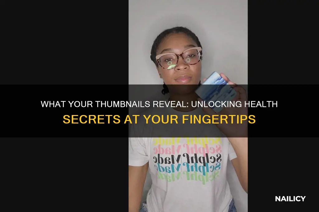 What Your Thumbnails Reveal: Unlocking Health Secrets At Your ...