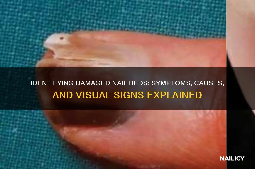 Identifying Damaged Nail Beds: Symptoms, Causes, And Visual Signs ...