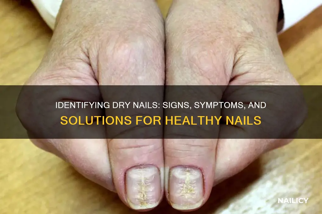 Identifying Dry Nails: Signs, Symptoms, And Solutions For Healthy Nails ...