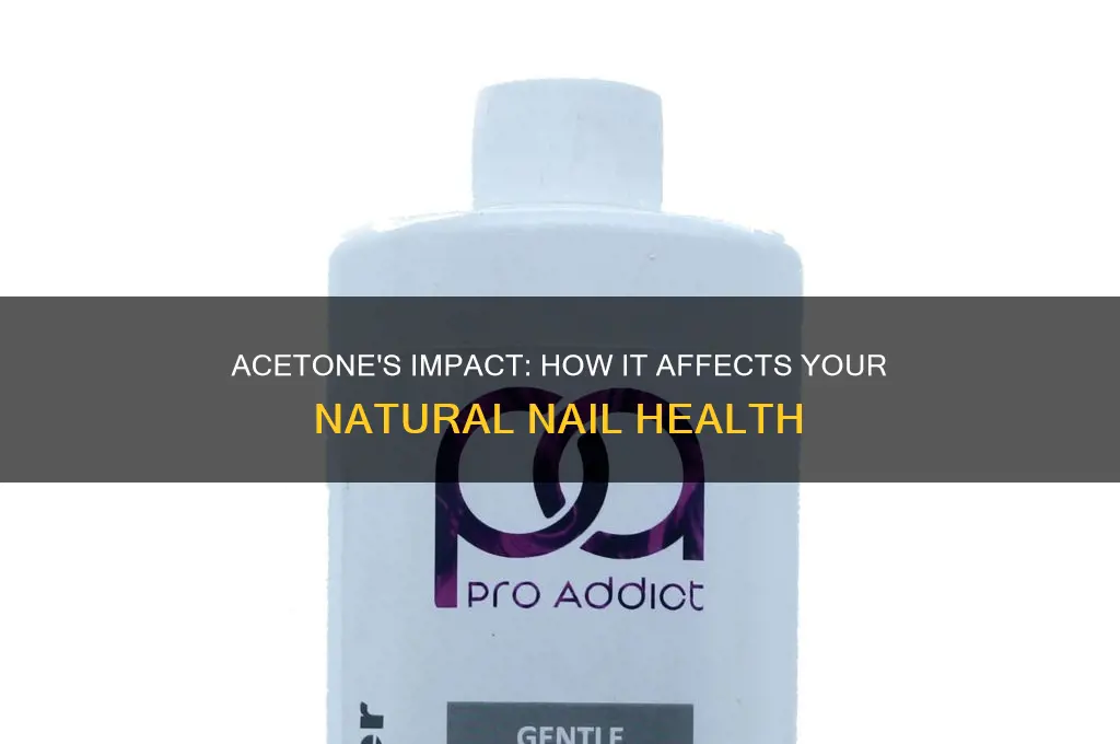 Acetone's Impact: How It Affects Your Natural Nail Health | Nailicy