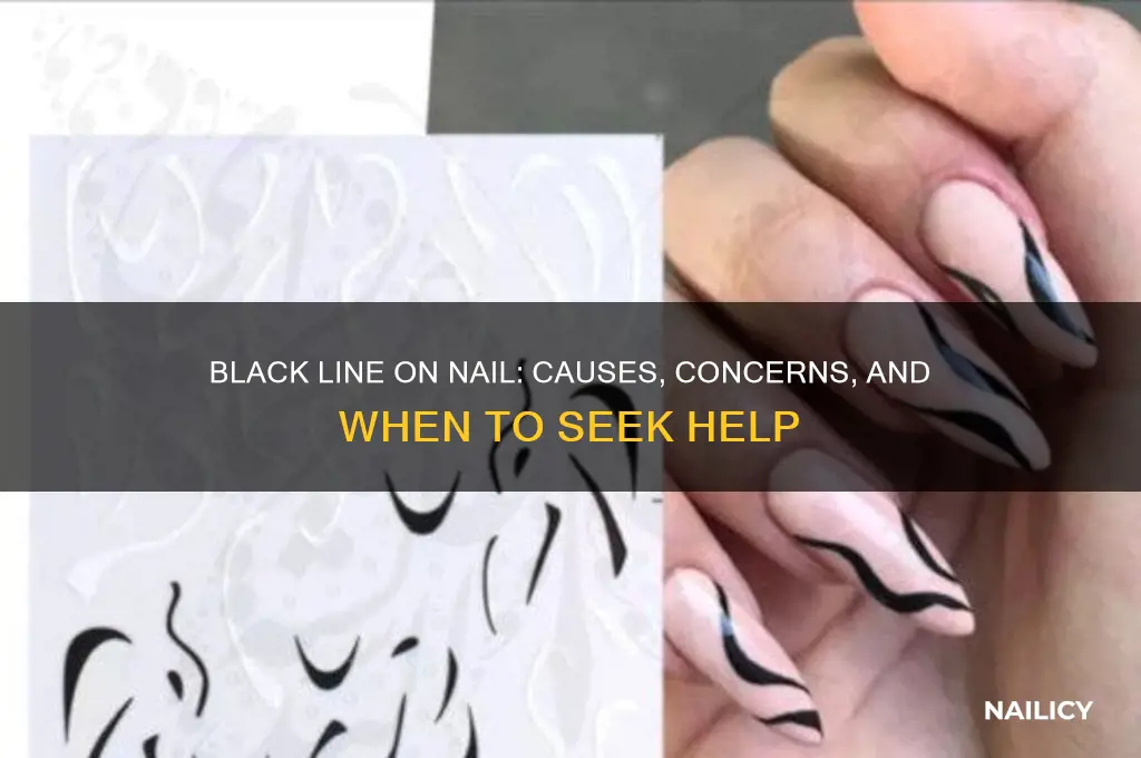 Black Line On Nail: Causes, Concerns, And When To Seek Help | Nailicy
