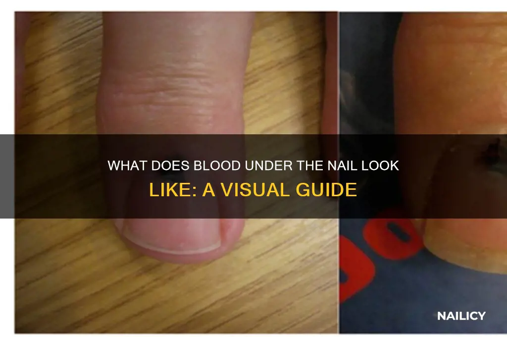 What Does Blood Under The Nail Look Like: A Visual Guide | Nailicy