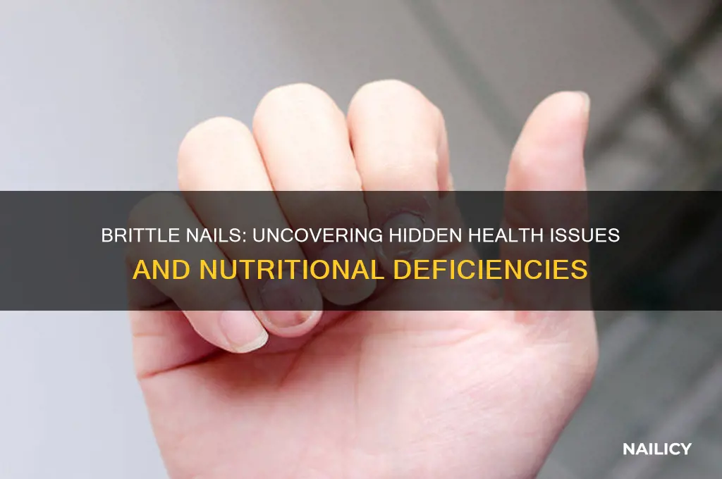 Brittle Nails: Uncovering Hidden Health Issues And Nutritional ...