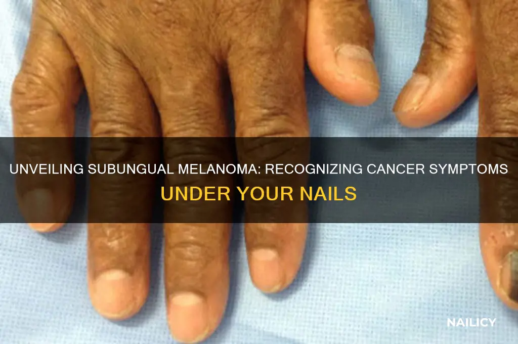 Unveiling Subungual Melanoma: Recognizing Cancer Symptoms Under Your ...