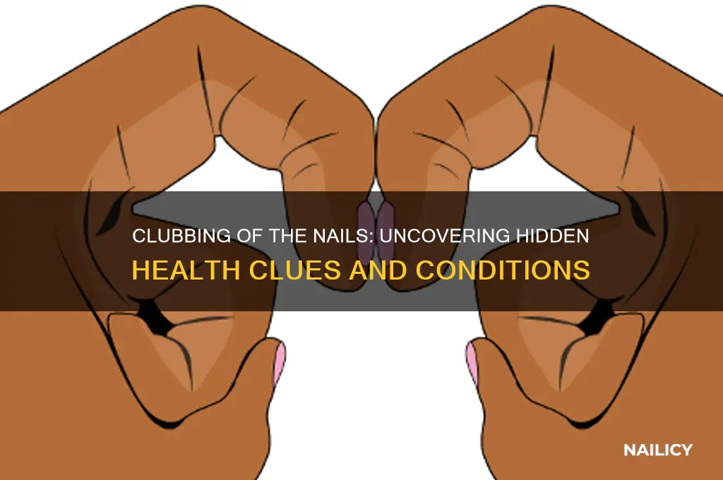 Clubbing Of The Nails: Uncovering Hidden Health Clues And Conditions ...