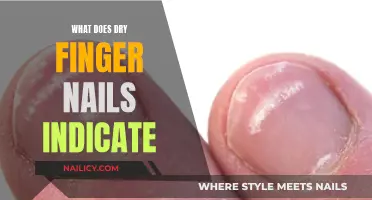Ingrown Fingernail: Appearance And Symptoms Explained | Nailicy
