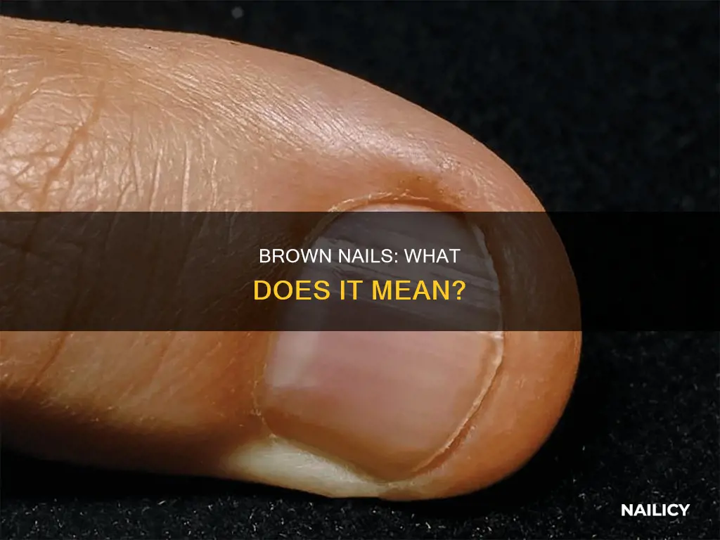 Brown Nails: What Does It Mean? | Nailicy