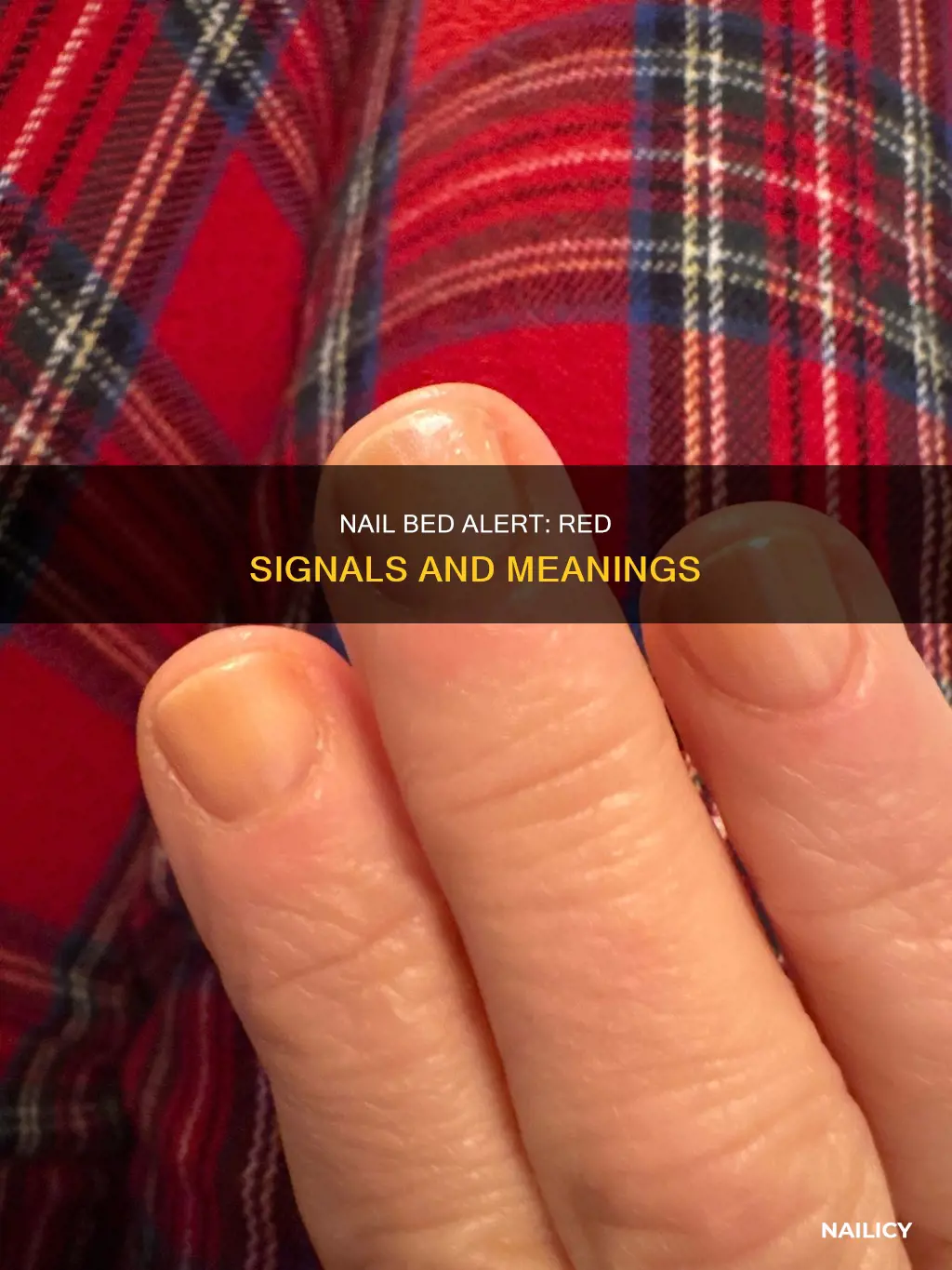 Nail Bed Alert: Red Signals And Meanings | Nailicy