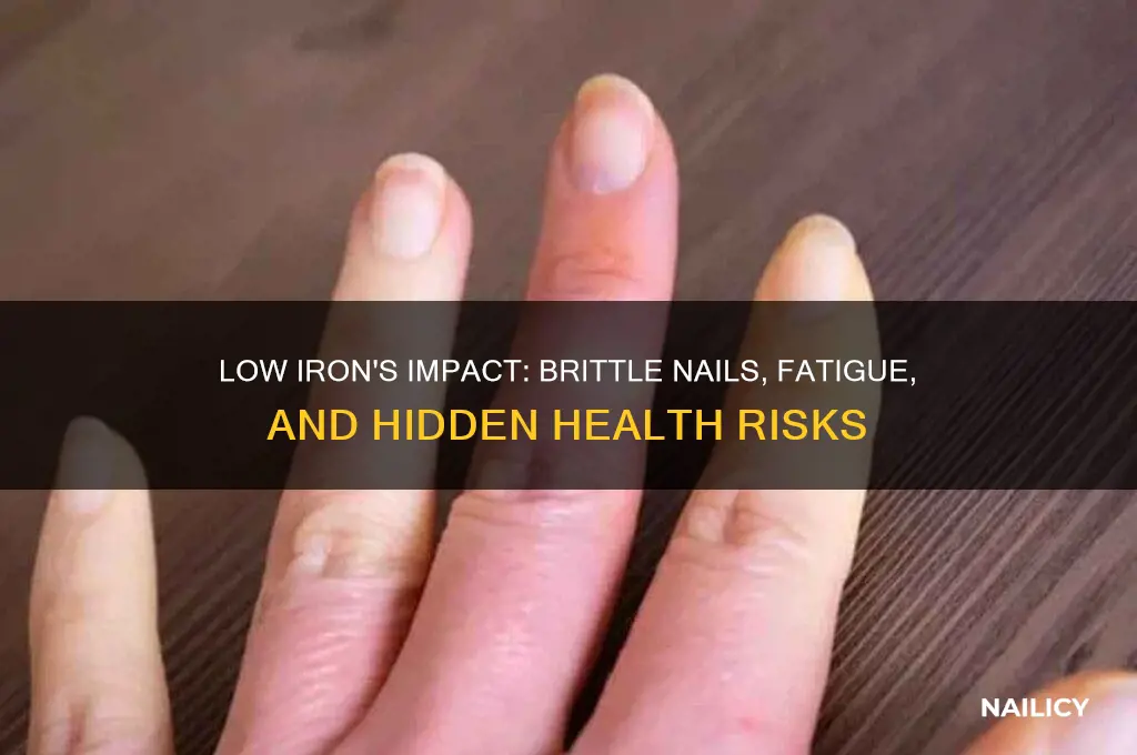 Low Iron's Impact: Brittle Nails, Fatigue, And Hidden Health Risks ...
