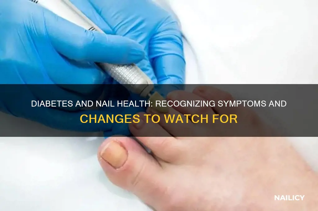 Diabetes And Nail Health: Recognizing Symptoms And Changes To Watch For ...