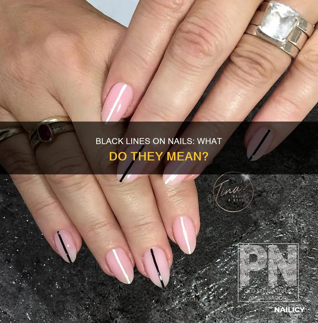 Black Lines On Nails What Do They Mean Nailicy