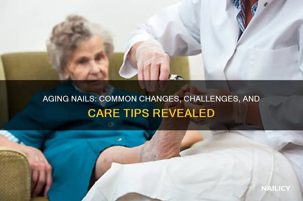 Aging Nails: Common Changes, Challenges, And Care Tips Revealed | Nailicy