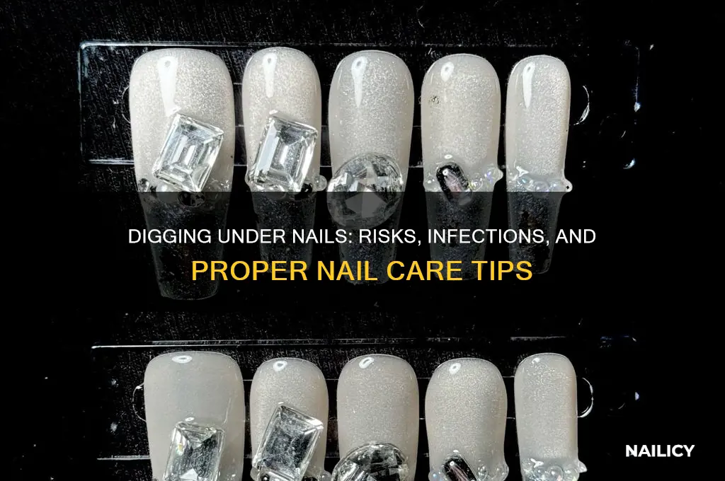 Digging Under Nails: Risks, Infections, And Proper Nail Care Tips | Nailicy