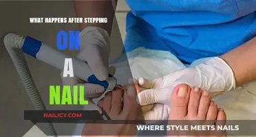 Pulling Your Nail Off: Risks, Pain, And Recovery Explained | Nailicy