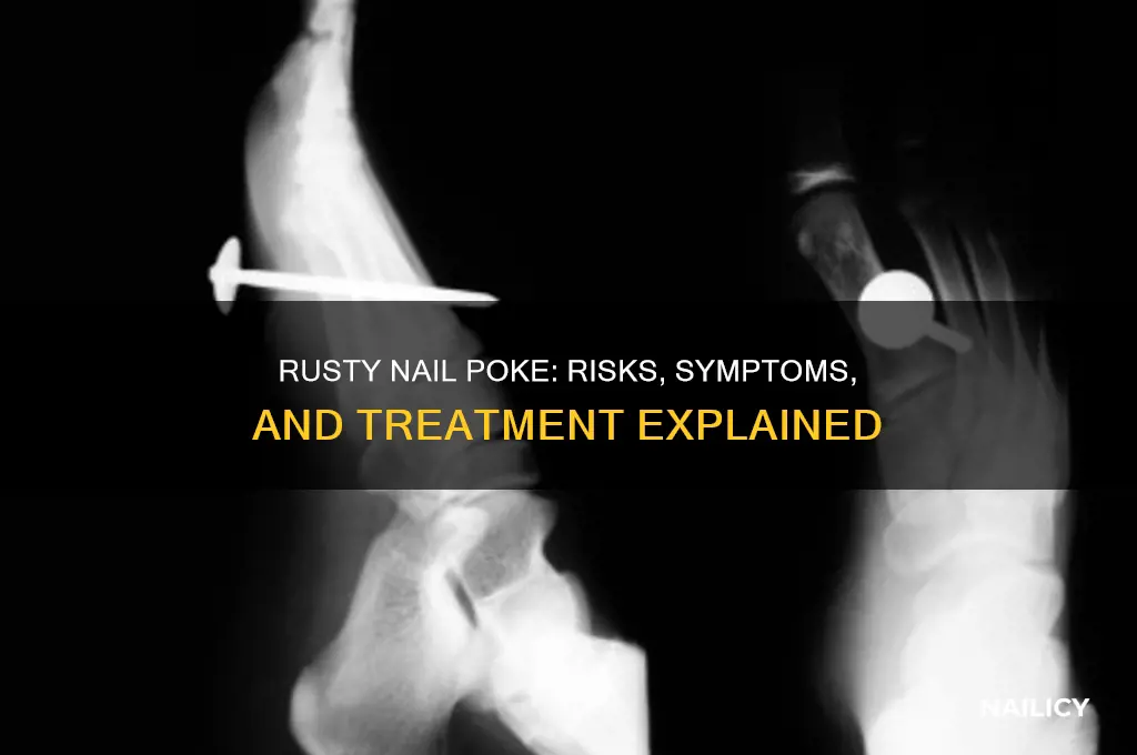 Rusty Nail Poke: Risks, Symptoms, And Treatment Explained | Nailicy