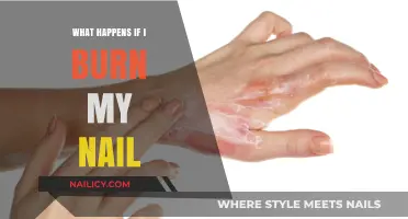 Nail Ripped Off: Pain, Healing, And Recovery Explained | Nailicy