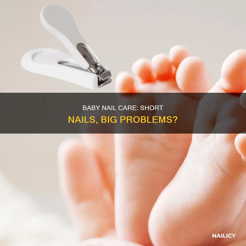 Baby Nail Care: Short Nails, Big Problems? | Nailicy