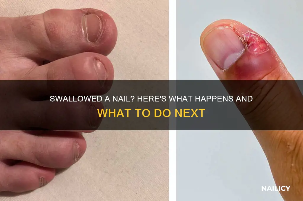 Swallowed A Nail? Here's What Happens And What To Do Next | Nailicy