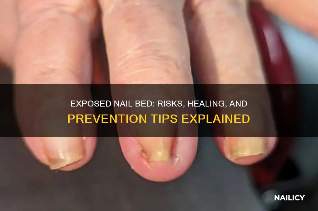 Exposed Nail Bed: Risks, Healing, And Prevention Tips Explained | Nailicy
