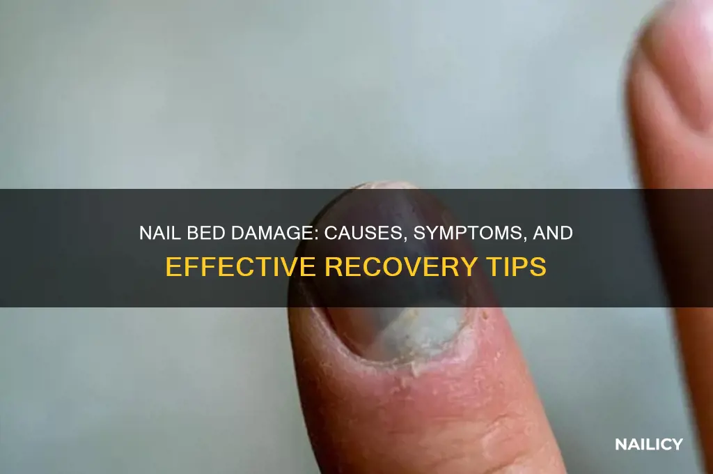 Nail Bed Damage: Causes, Symptoms, And Effective Recovery Tips | Nailicy