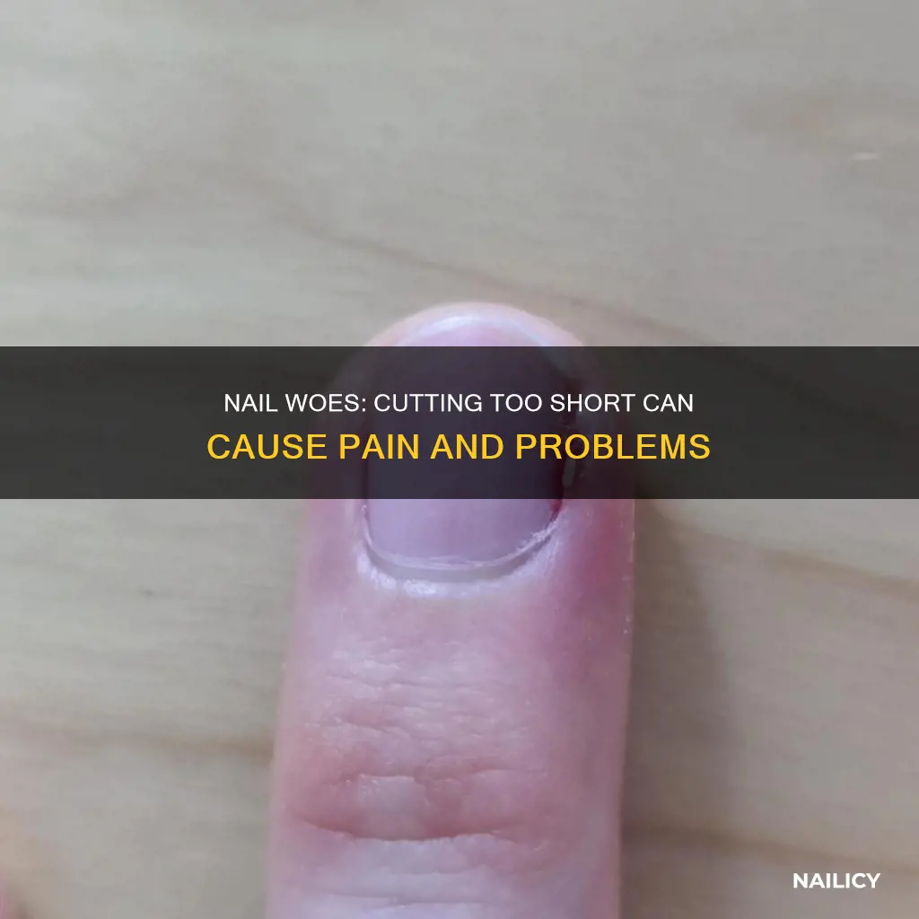 Nail Woes: Cutting Too Short Can Cause Pain And Problems | Nailicy