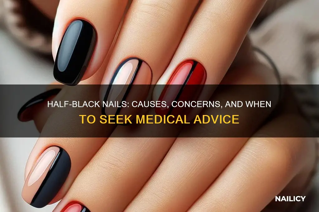 Half-Black Nails: Causes, Concerns, And When To Seek Medical Advice ...