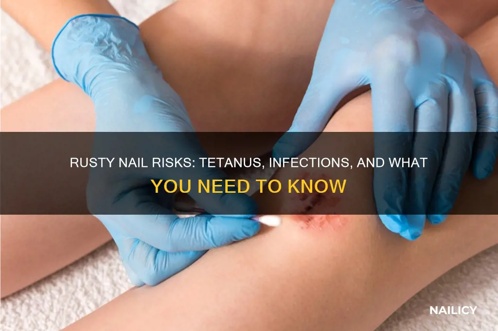 Rusty Nail Risks: Tetanus, Infections, And What You Need To Know | Nailicy