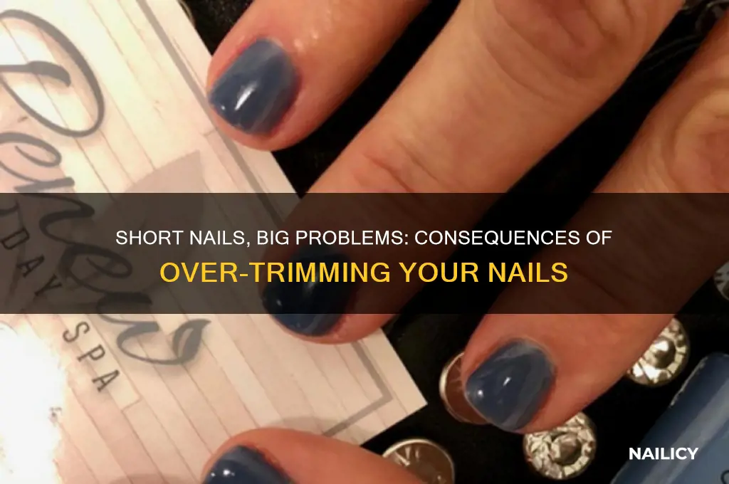 Short Nails, Big Problems: Consequences Of Over-Trimming Your Nails ...