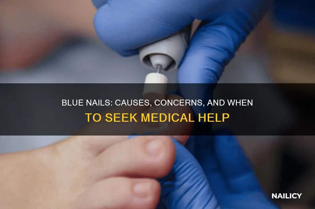 Blue Nails: Causes, Concerns, And When To Seek Medical Help | Nailicy
