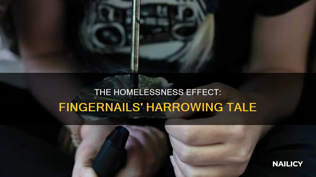 The Homelessness Effect: Fingernails' Harrowing Tale | Nailicy