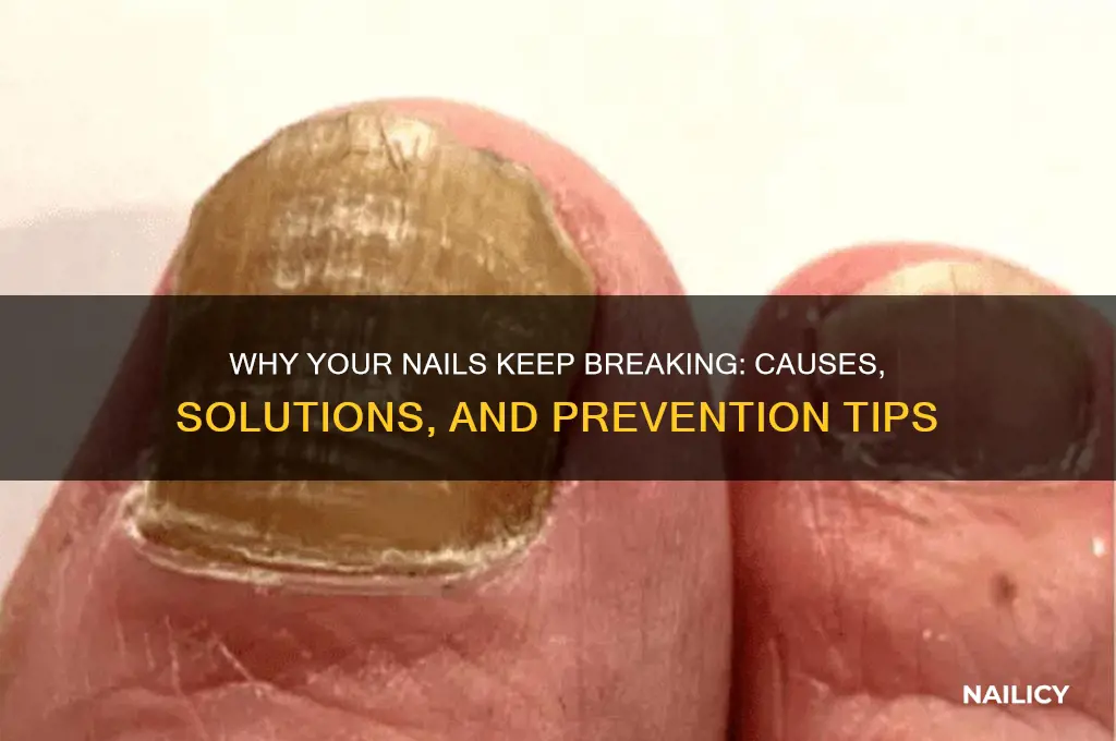 Why Your Nails Keep Breaking: Causes, Solutions, And Prevention Tips ...