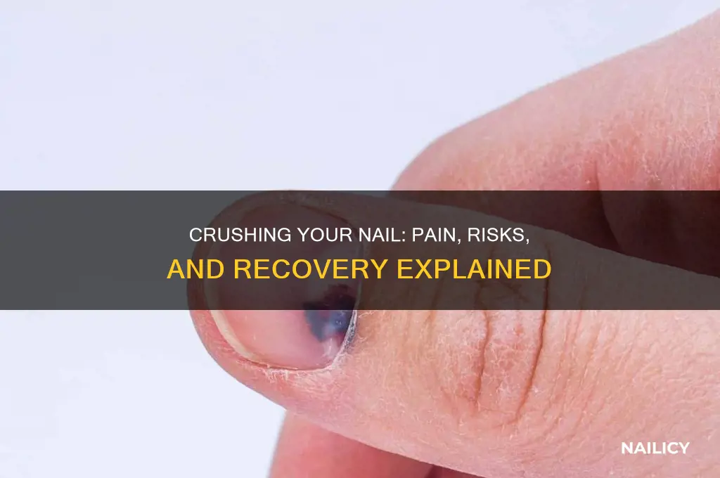 Crushing Your Nail: Pain, Risks, And Recovery Explained | Nailicy