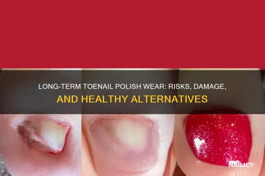 Long-Term Toenail Polish Wear: Risks, Damage, And Healthy Alternatives ...