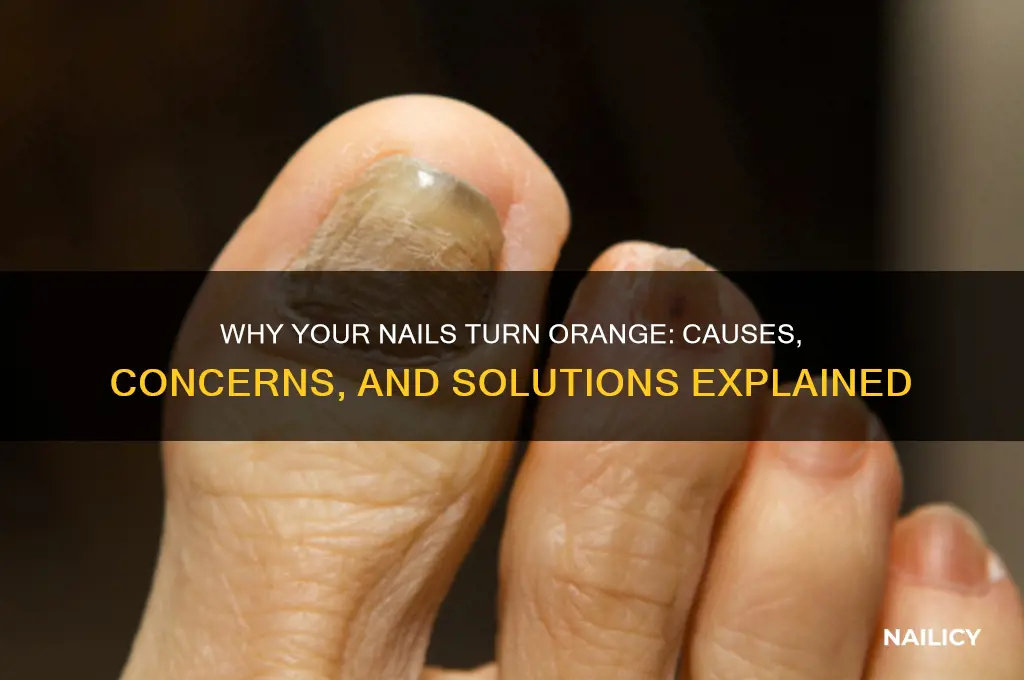 Why Your Nails Turn Orange: Causes, Concerns, And Solutions Explained ...