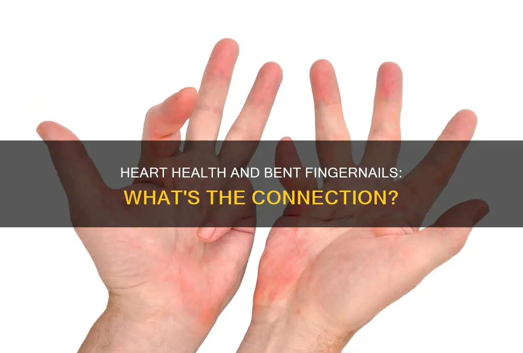 Heart Health And Bent Fingernails: What's The Connection? | Nailicy