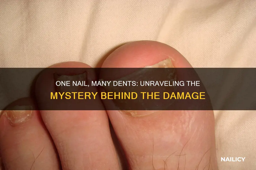 One Nail, Many Dents: Unraveling The Mystery Behind The Damage | Nailicy