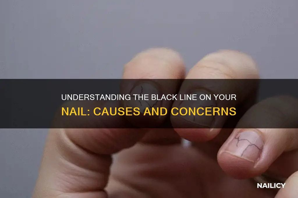 Understanding The Black Line On Your Nail: Causes And Concerns | Nailicy