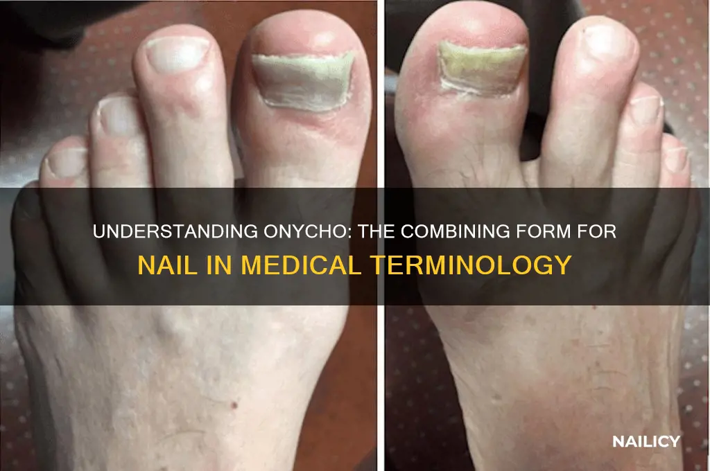 Understanding Onycho: The Combining Form For Nail In Medical ...