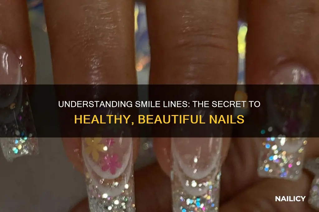 Understanding Smile Lines: The Secret To Healthy, Beautiful Nails | Nailicy
