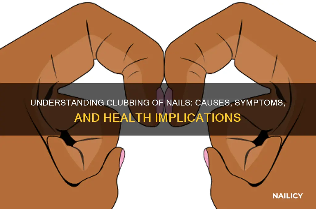 Understanding Clubbing Of Nails: Causes, Symptoms, And Health ...